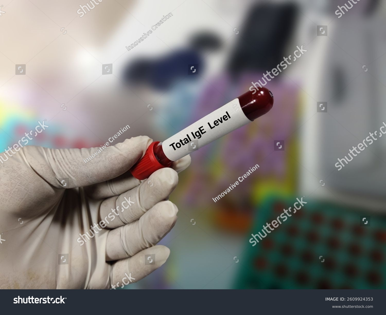 Best IgE Test 01797522136
